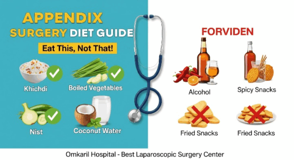 Post-Laparoscopic Appendectomy Diet: What to Eat and Avoid for Faster ...
